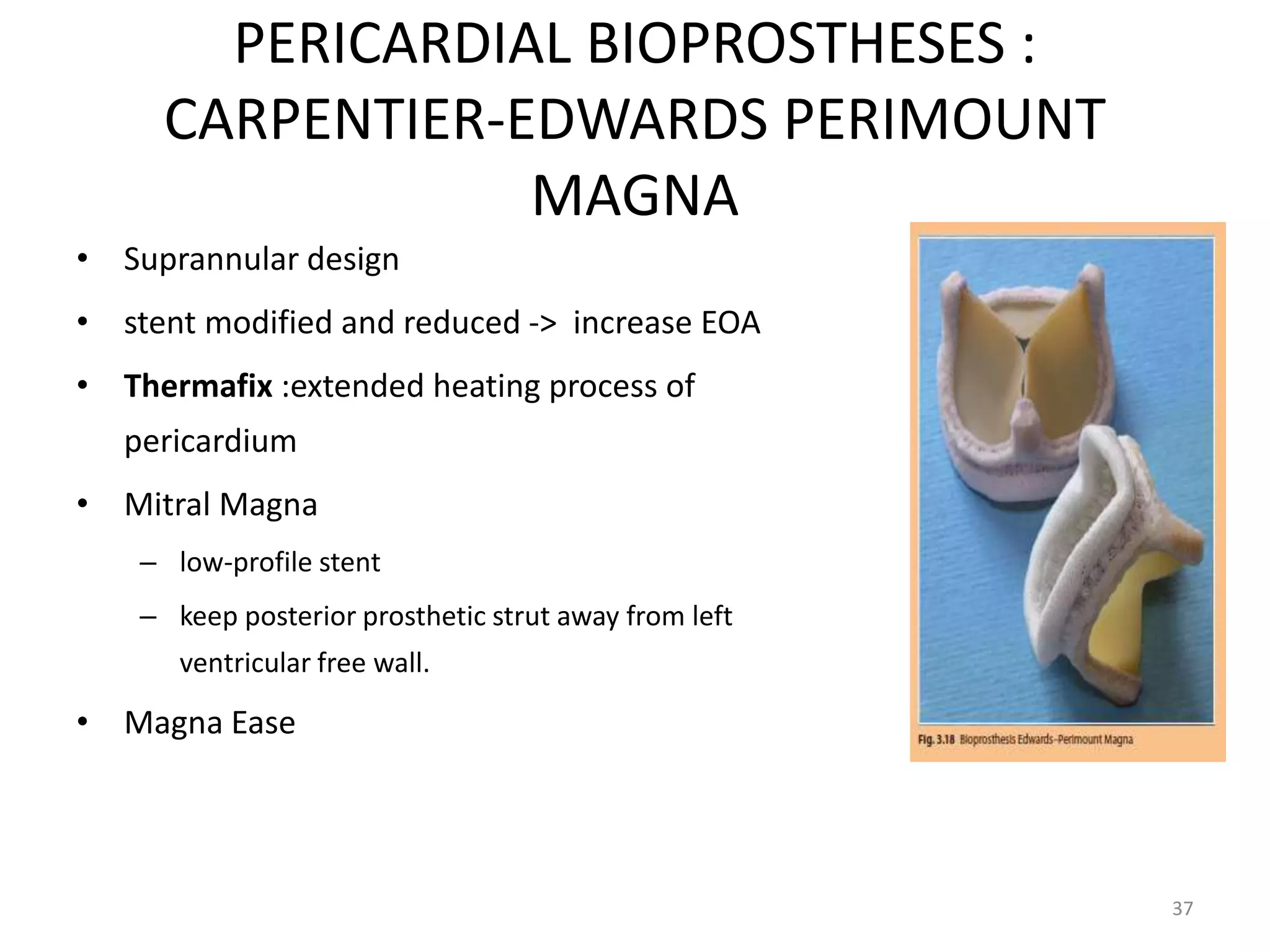 Bioprostheic heart valve prosthesis | PPTX