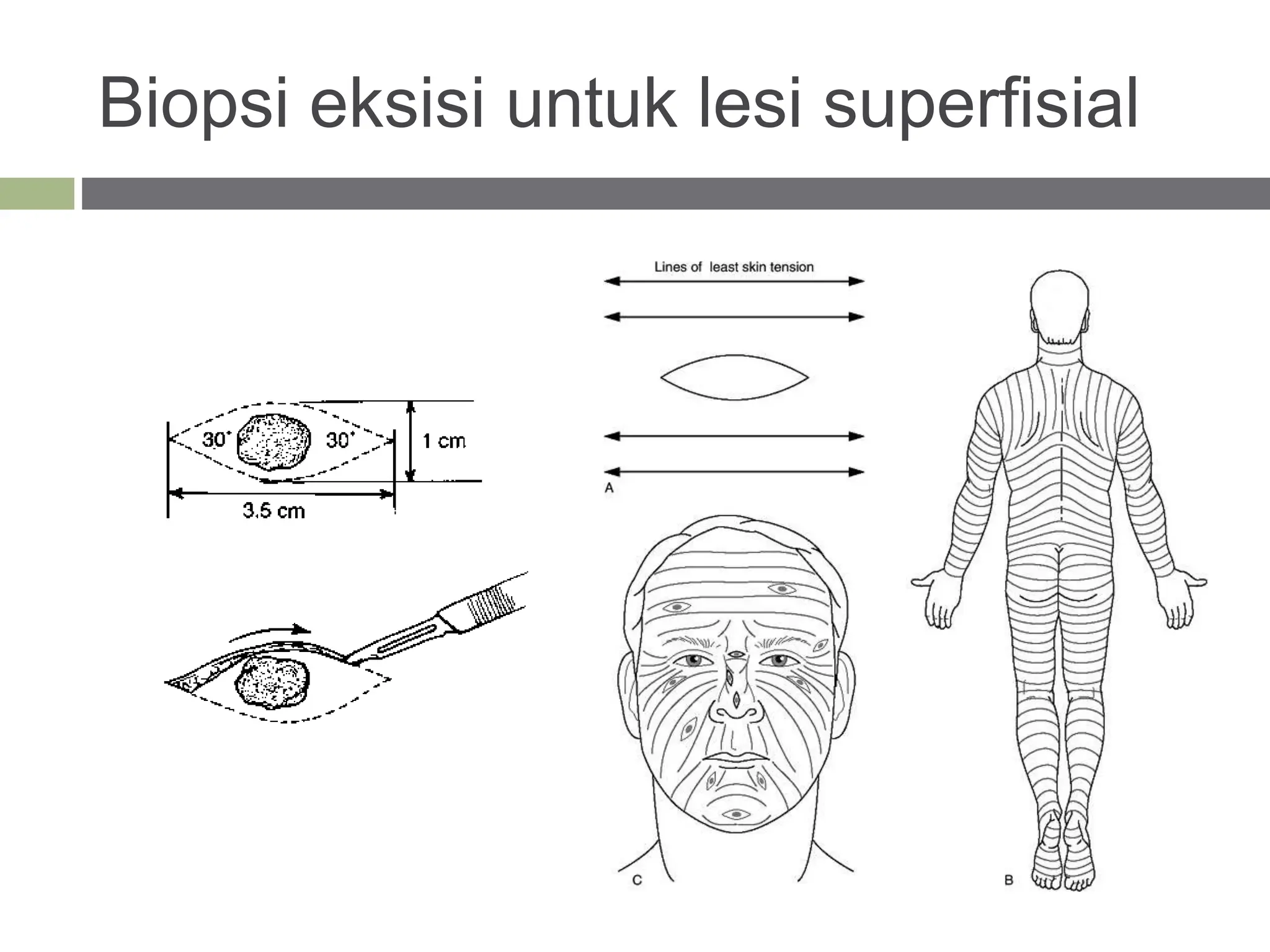 Biopsi.pptx