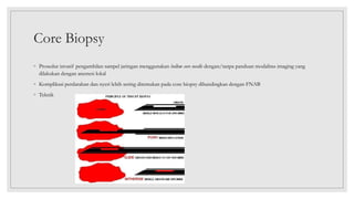 dasar histopatologi biopsi pada neoplasma | PPT