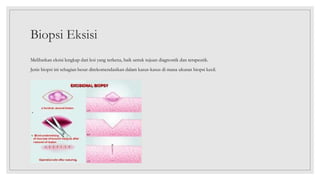 dasar histopatologi biopsi pada neoplasma | PPT