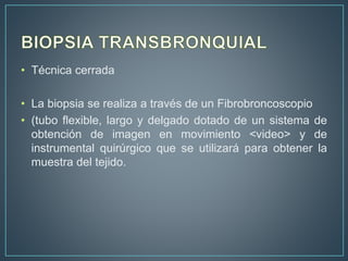 Biopsia pulmonar | PPTX