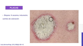 Biopsia.pptx