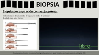 Biopsia y tipos de biopsia diagnostico.pptx