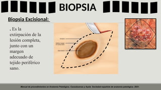 Biopsia y tipos de biopsia diagnostico.pptx