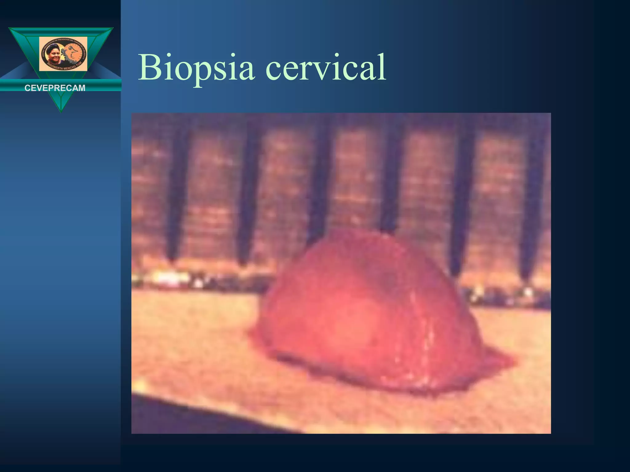 Biopsia cervical | PDF | Surgery | Medical Health