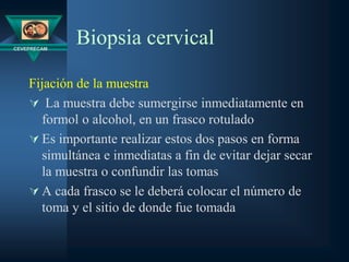 Biopsia cervical | PDF