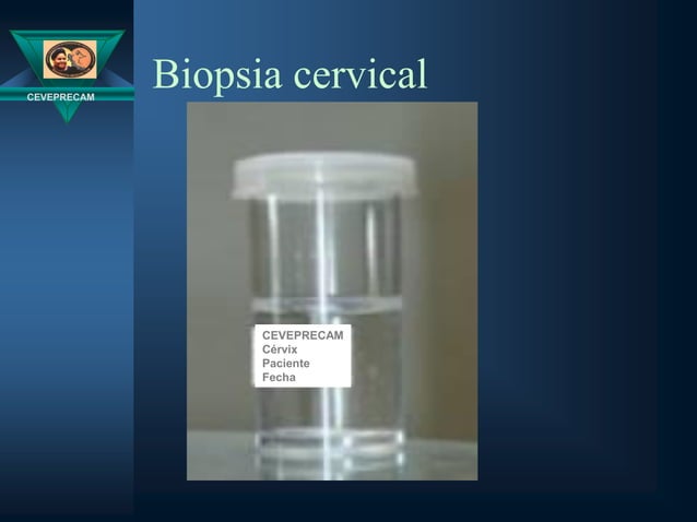 Biopsia cervical | PDF | Surgery | Medical Health