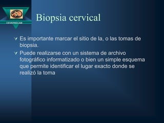 Biopsia cervical | PDF