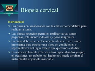 Biopsia cervical | PDF