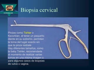 Biopsia cervical | PDF