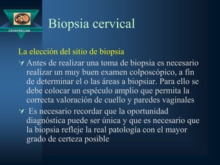 Biopsia cervical | PDF