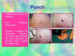 Biopsia cutanea | PPTX