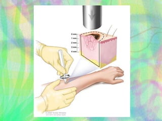Biopsia cutanea | PPTX