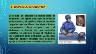biopsia, dialisis peritoneal y hemodialisis.pptx