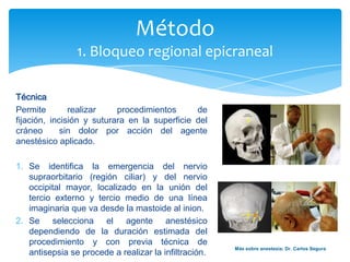 Biopsia guiada por estereotaxia | PPTX
