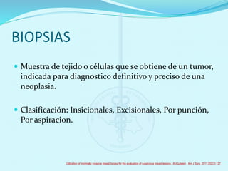Biopsia mama | PPTX
