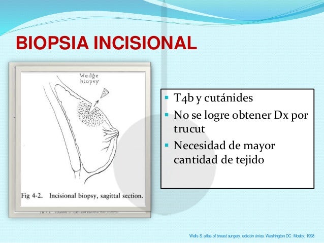 BIOPSIA INCISIONAL Y EXCISIONAL PDF