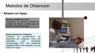 biopsias jos.pptx