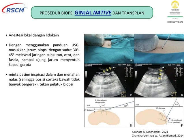 materi modul intervensi biopsi ginj.pptx