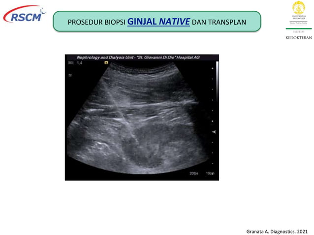 materi modul intervensi biopsi ginj.pptx