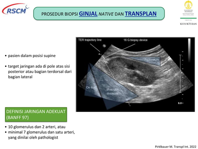 materi modul intervensi biopsi ginj.pptx