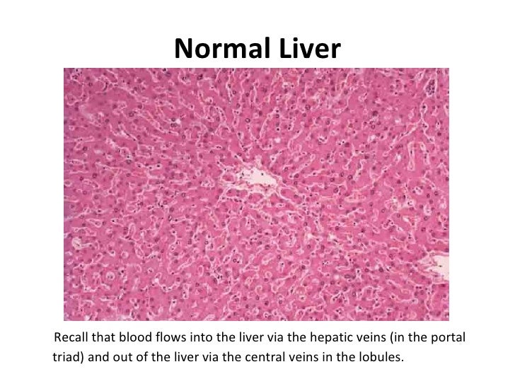 Liver Biopsy