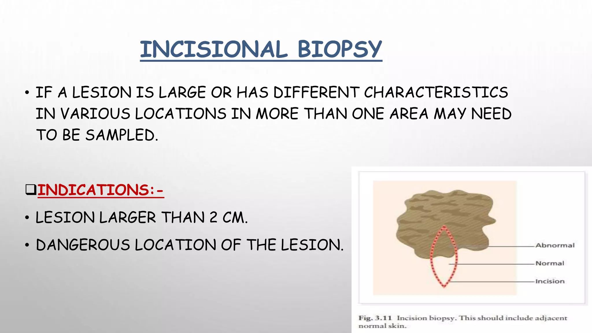 BIOPSY | PPTX