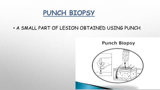BIOPSY | PPTX