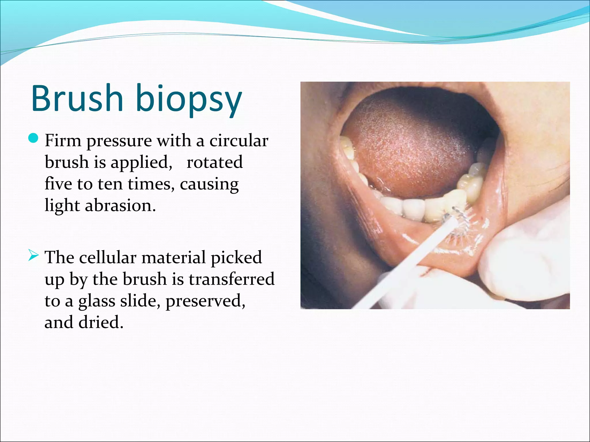 Biopsy | PPT