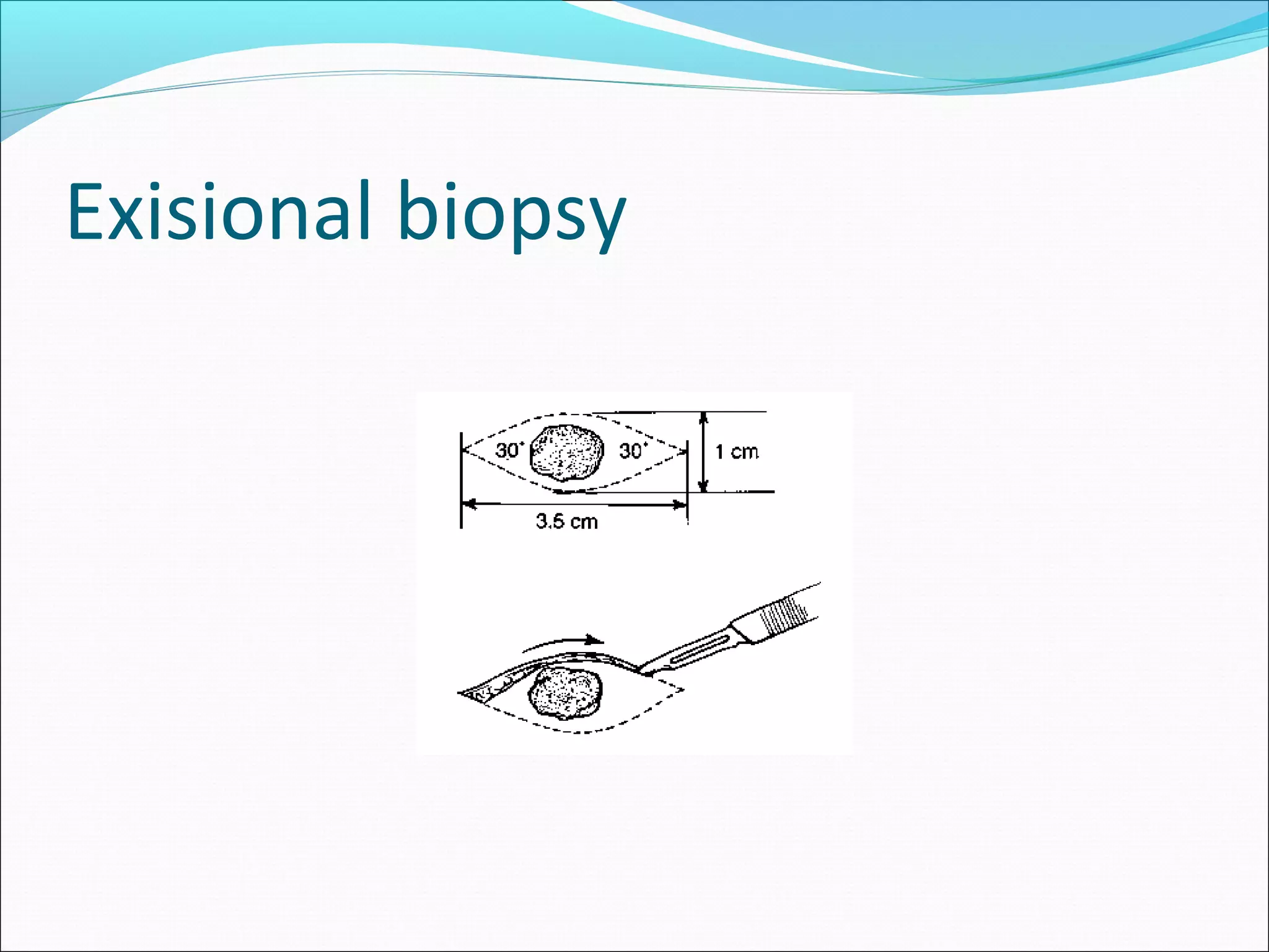 Biopsy | PPT