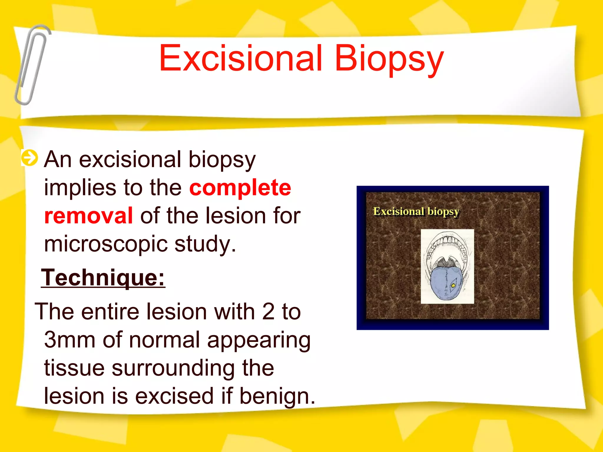 Biopsy | PPT