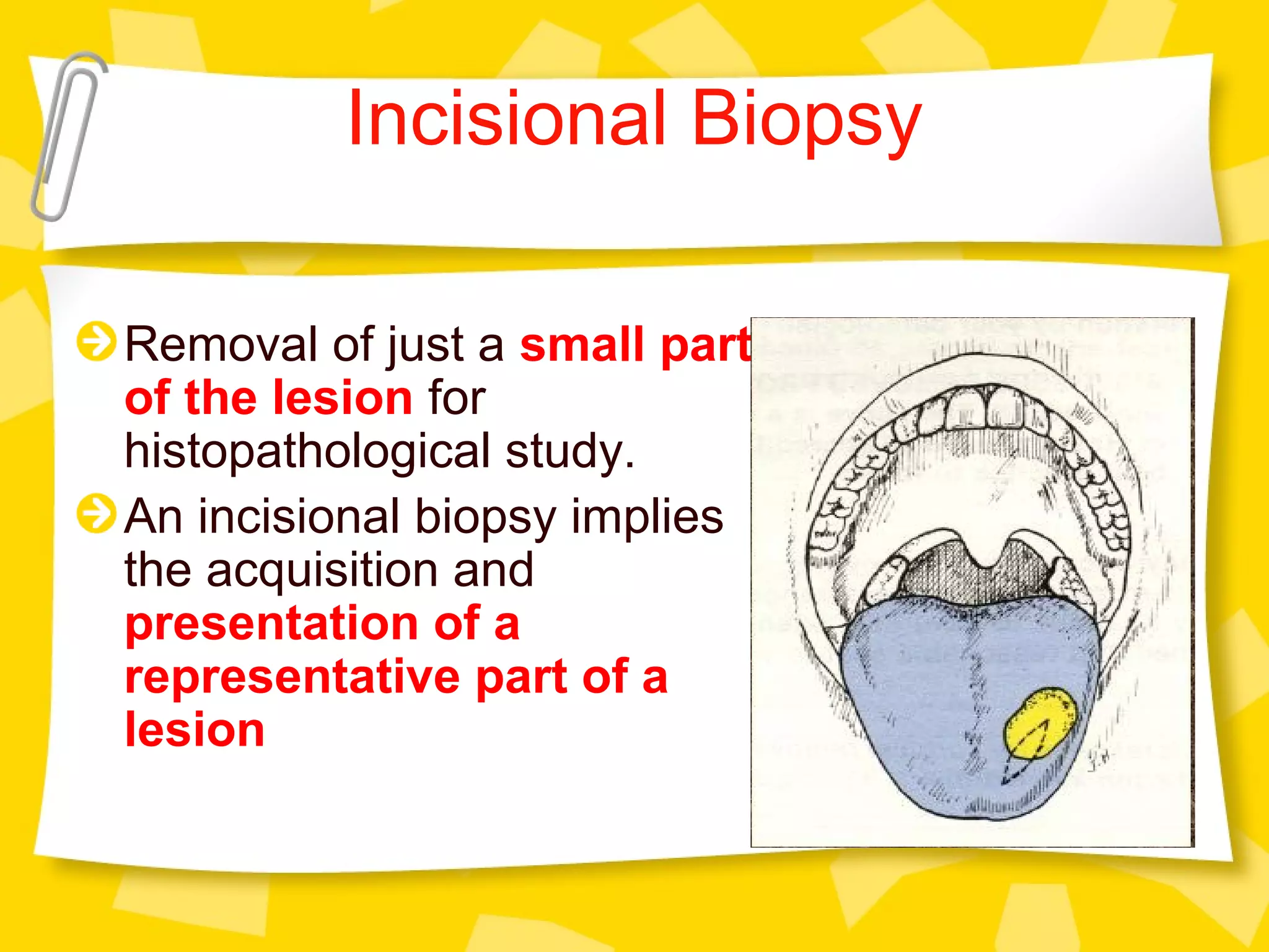 Biopsy | PPT