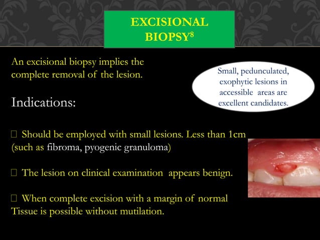 Oral Biopsy | PPTX