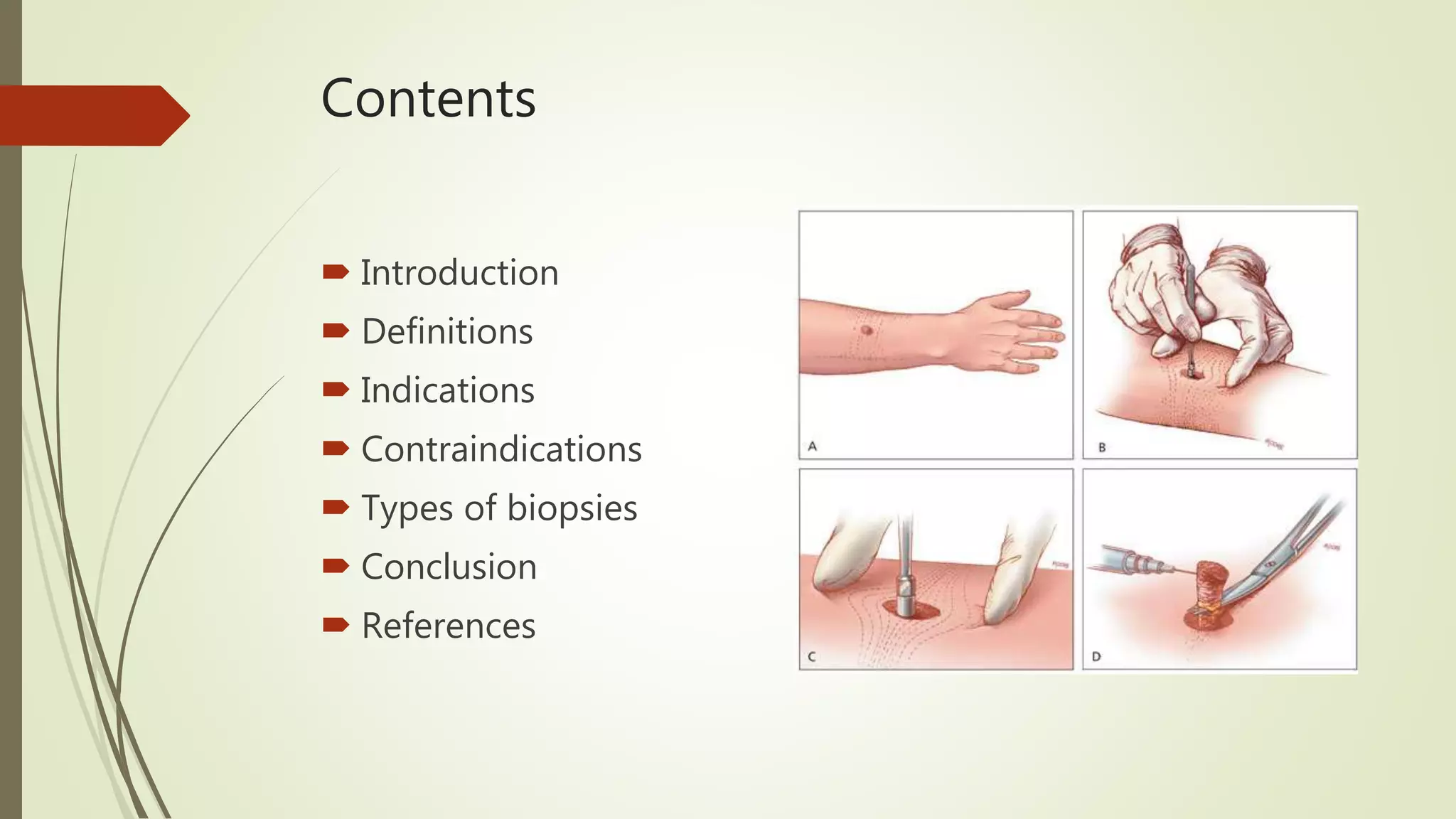 Biopsy | PPTX