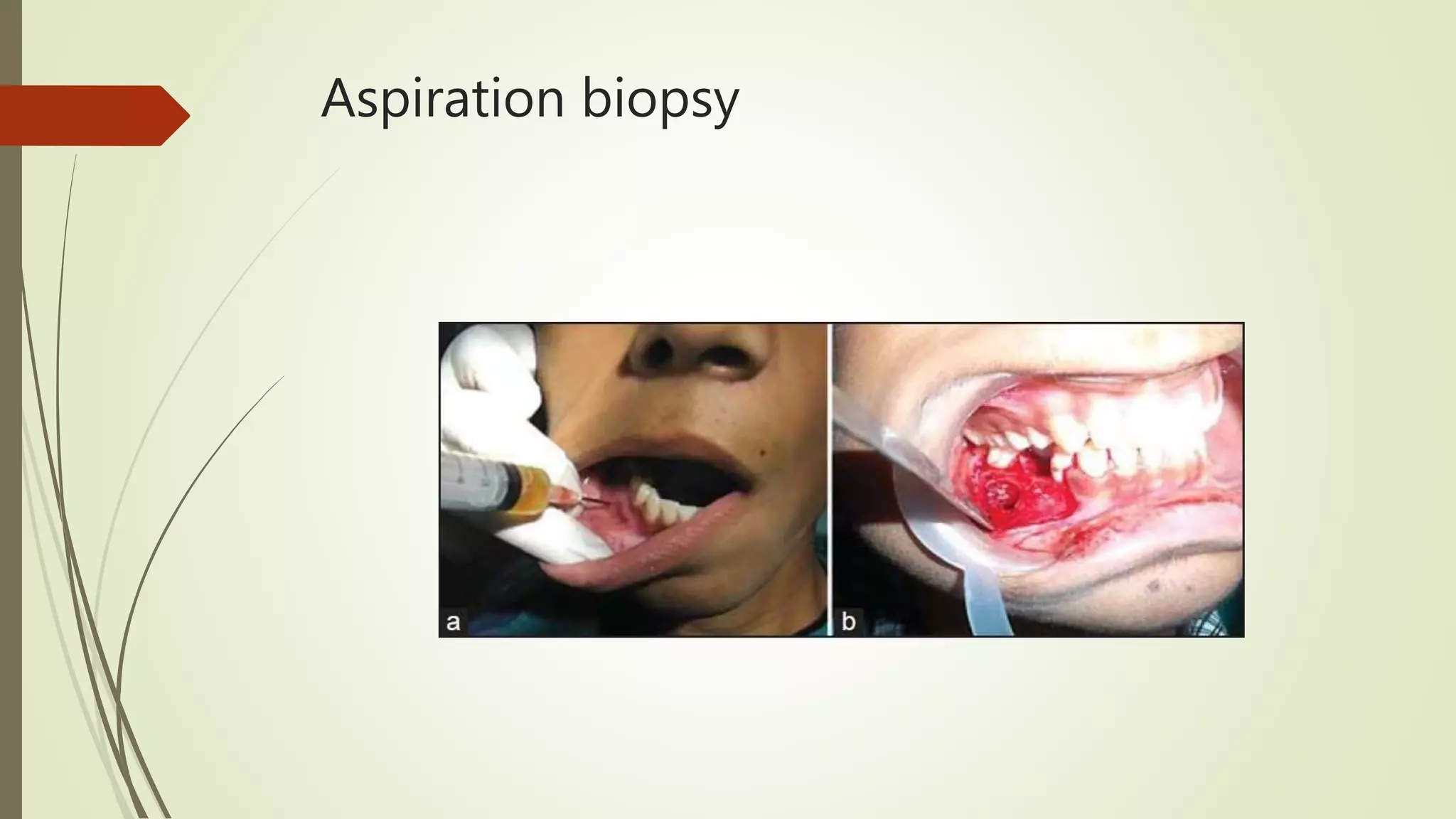 Biopsy | PPTX