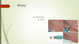 Biopsy | PPTX