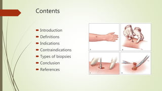 Biopsy | PPTX