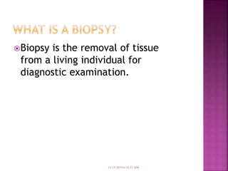 Biopsy | PPT