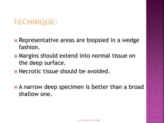 Biopsy | PPT