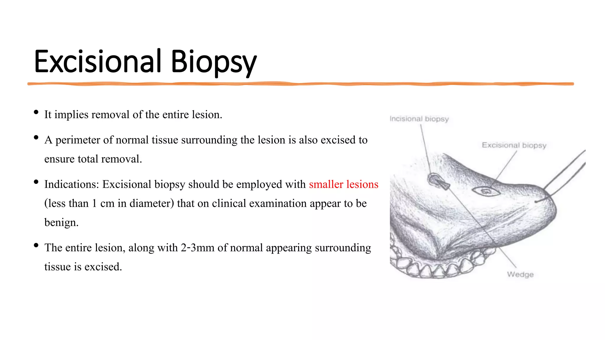 Biopsy in oral and maxillofacial surgery by Dr. Shreya Das | PPTX