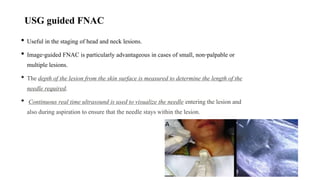 Biopsy in oral and maxillofacial surgery by Dr. Shreya Das | PPTX