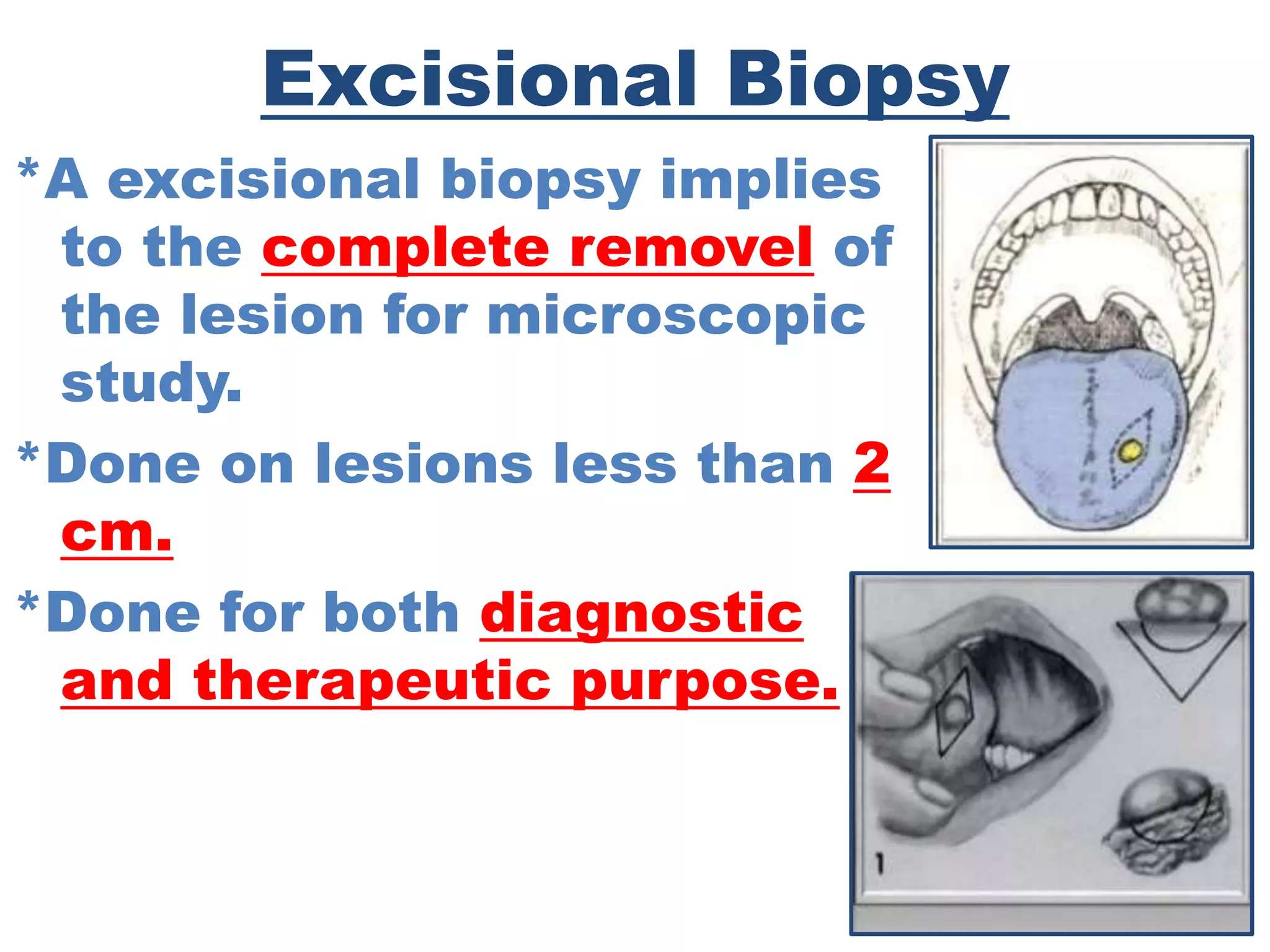 Biopsy.pptx