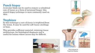 biopsy.pptx