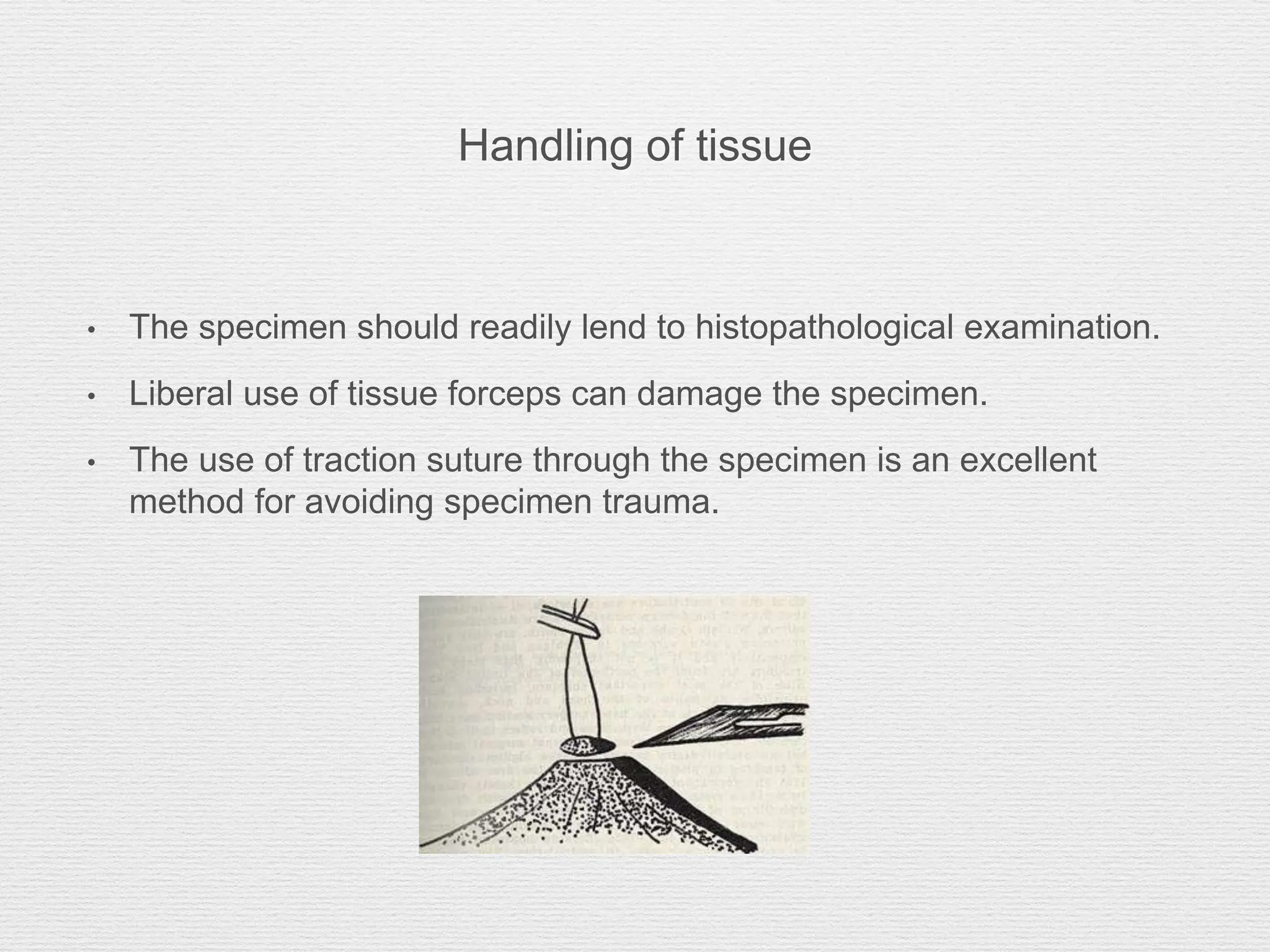 BIOPSY clinical procedure which aids in diagnosis and treatment ...