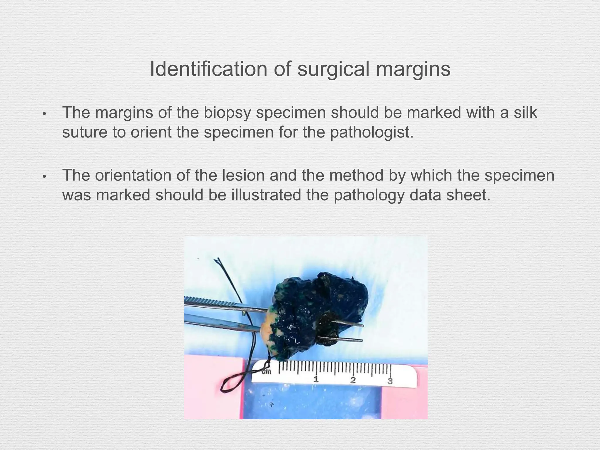 BIOPSY clinical procedure which aids in diagnosis and treatment ...