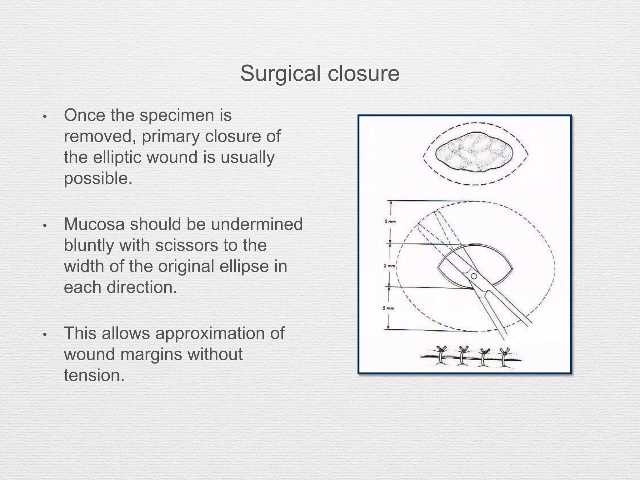 BIOPSY clinical procedure which aids in diagnosis and treatment ...