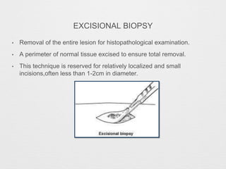 BIOPSY clinical procedure which aids in diagnosis and treatment ...