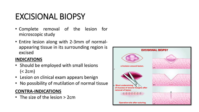 Biopsy of tissues and muscles Definition | PPT