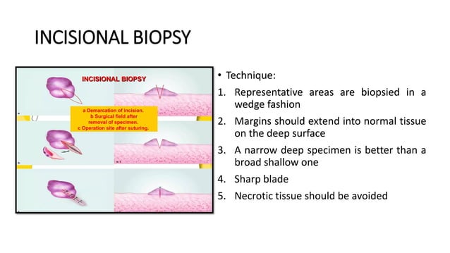Biopsy of tissues and muscles Definition | PPT