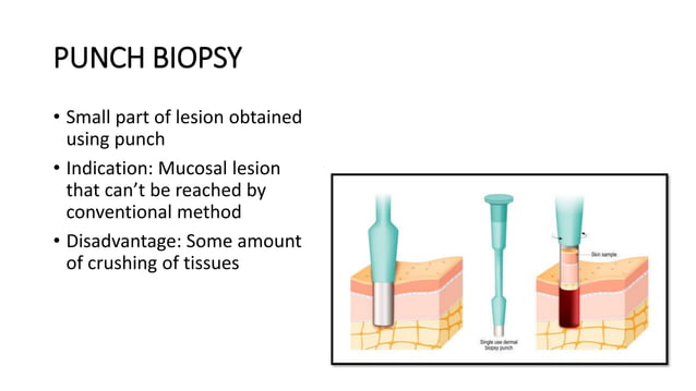 Biopsy of tissues and muscles Definition | PPT